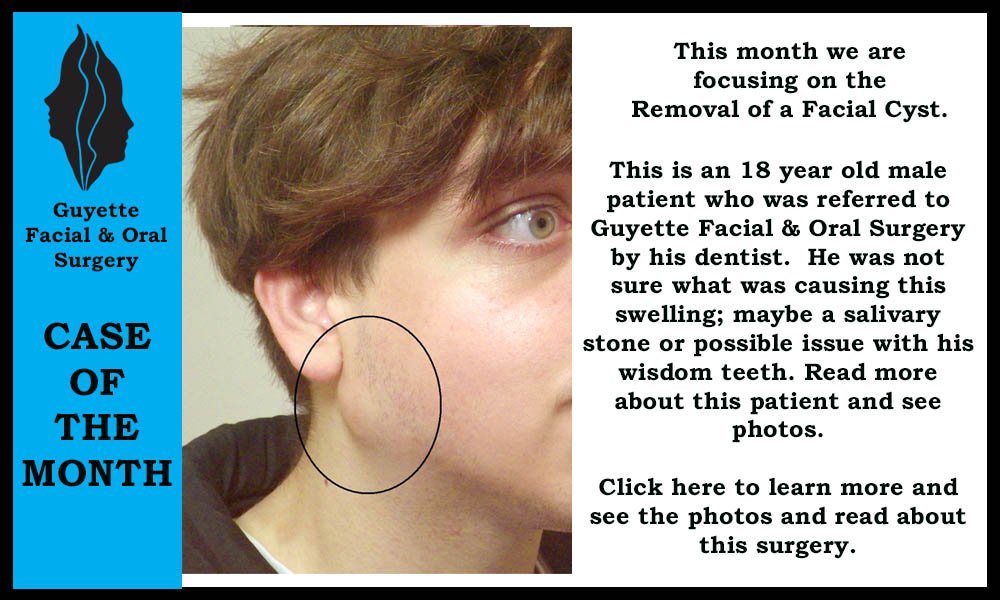 Guyette Facial & Oral Surgery CASE OF THE MONTH